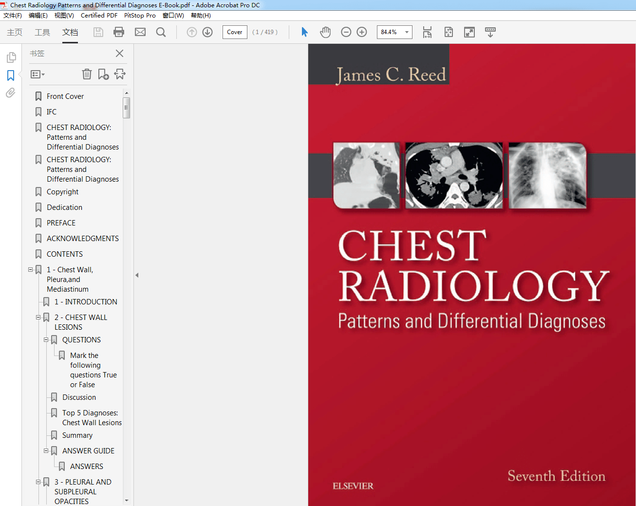 Chest Radiology Patterns and Differential Diagnoses – AttentiveSons Store