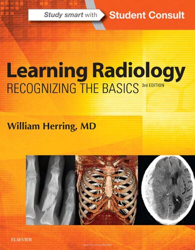 Learning radiology : recognizing the basics – AttentiveSons Store