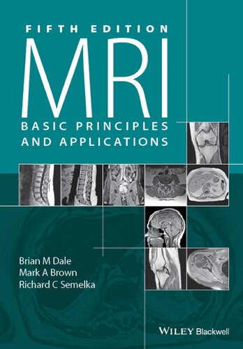 MRI Basic Principles and Applications – AttentiveSons Store