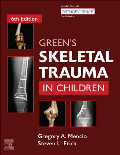 Ebook – Green 39’s Skeletal Trauma in Children (PDF Instant Download ...