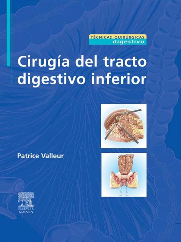 Cirugía del tracto digestivo inferior – Mezene Store