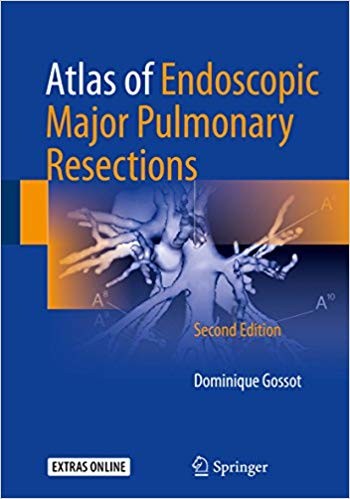 Atlas of Endoscopic Major Pulmonary Resections 2nd Edition – Auckoo Store