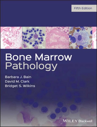 Bone Marrow Pathology – Mezene Store