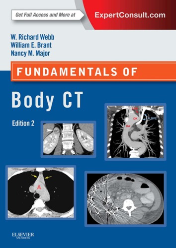 Fundamentals of body CT – AttentiveSons Store