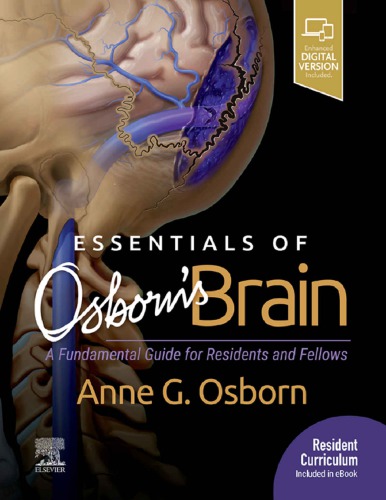 Essentials of Osborn’s Brain: A Fundamental Guide for Residents and ...