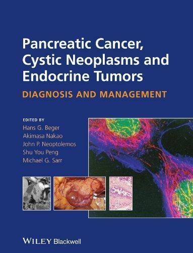 Pancreatic Cancer Cystic Neoplasms And Endocrine Tumors Diagnosis And ...